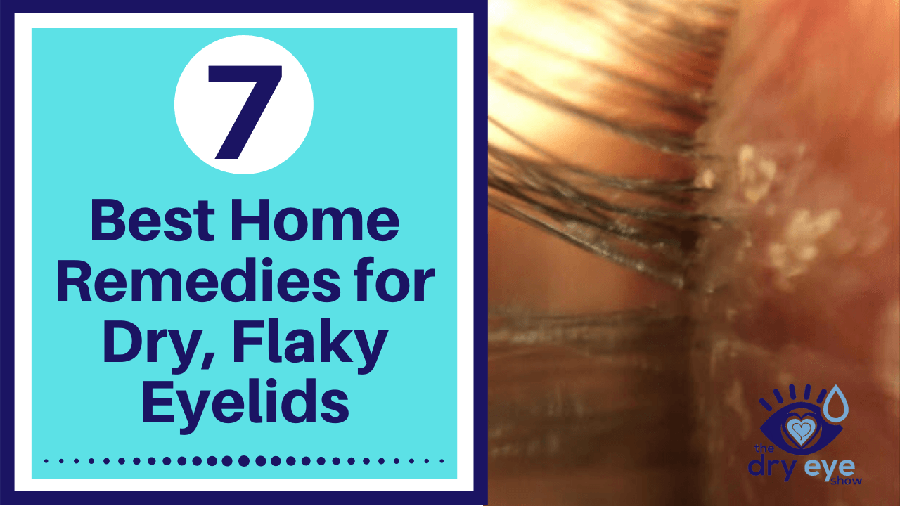 7 Best Home Remedies for Dry, Flaky Eyelids 😣 – Eye Love