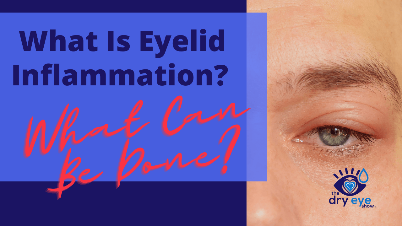 What Is Eyelid Inflammation? What Can Be Done? – Eye Love